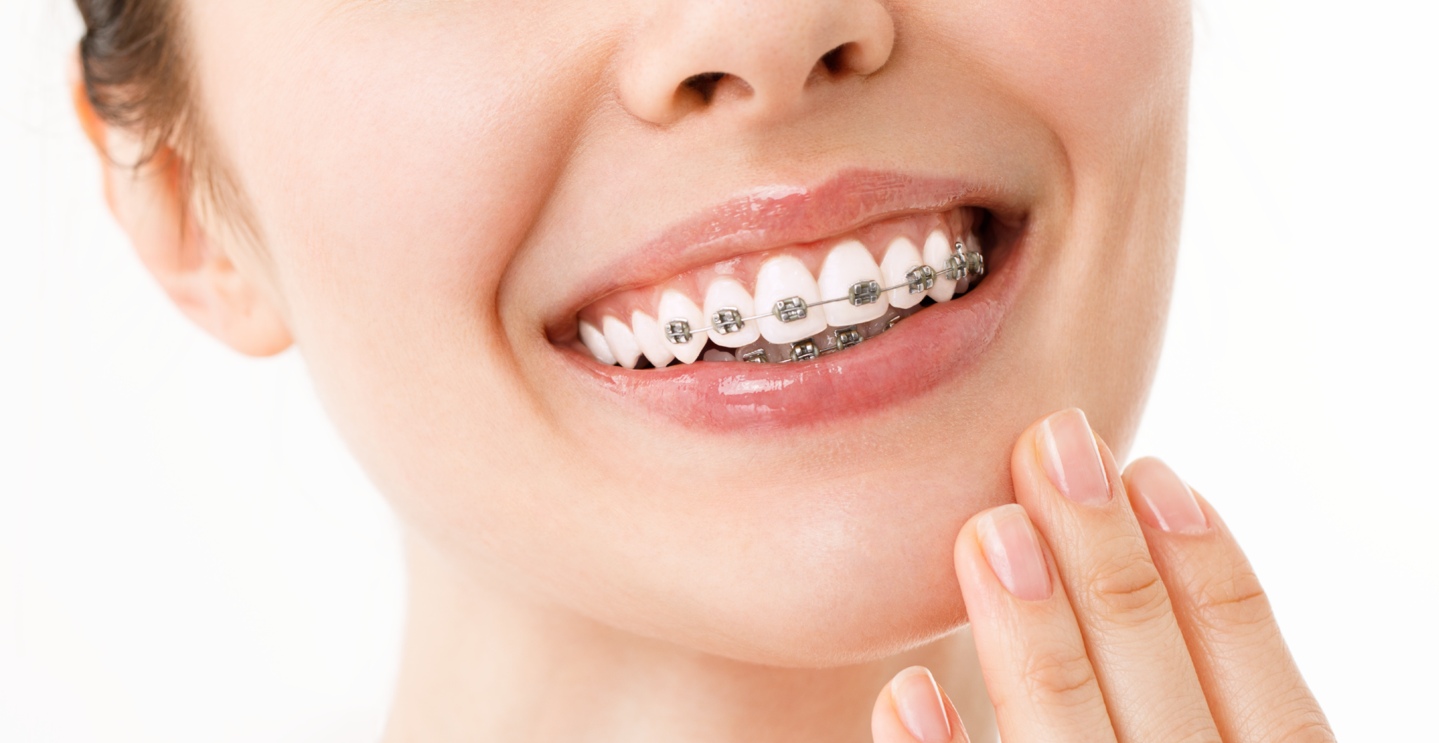 Cuidado bucal y la importancia de la seda dental al usar brackets ...